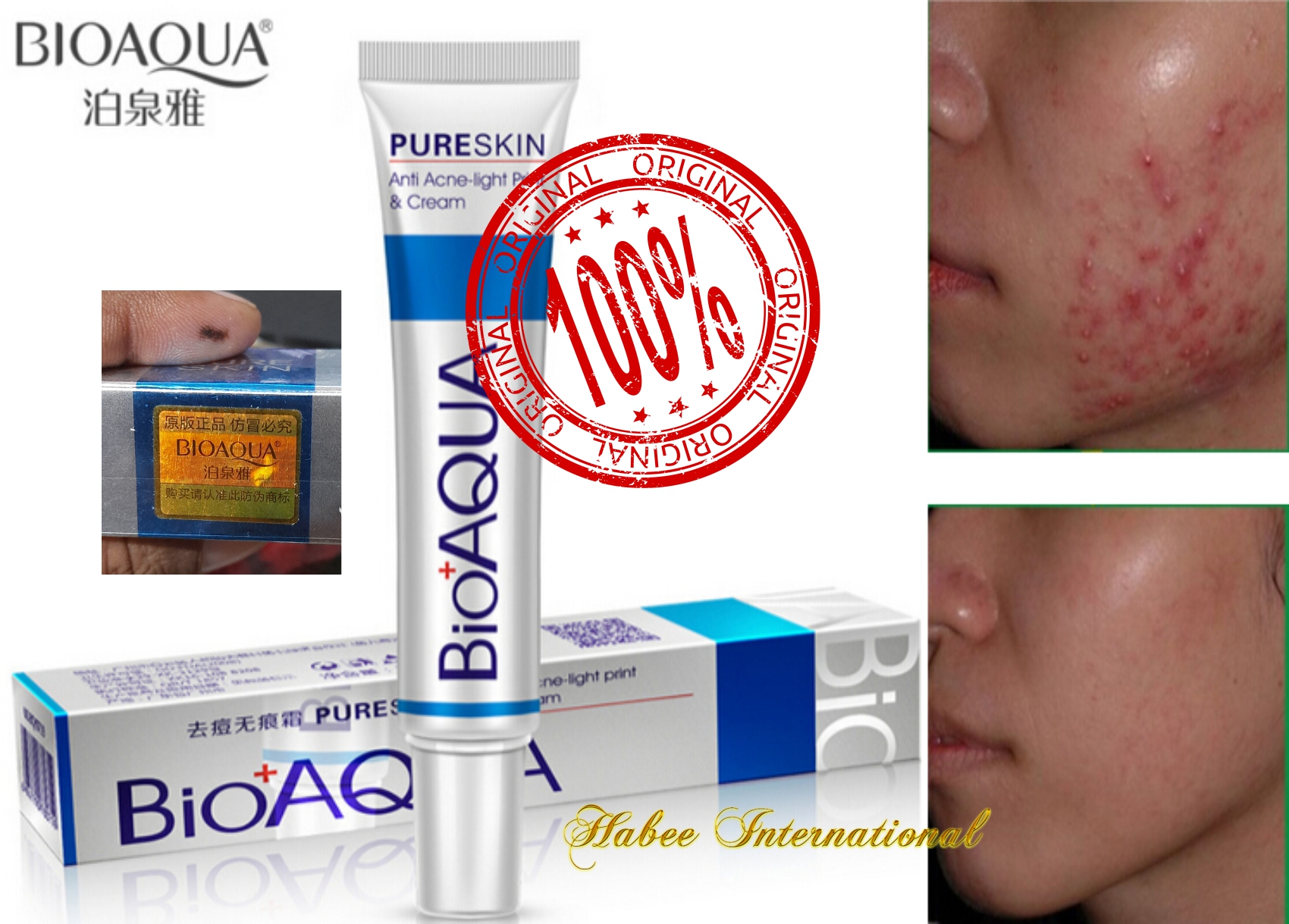 Bioaqua Natural Ingredient Pure Skin Anti Acne Scar Mark Remove Oil ...