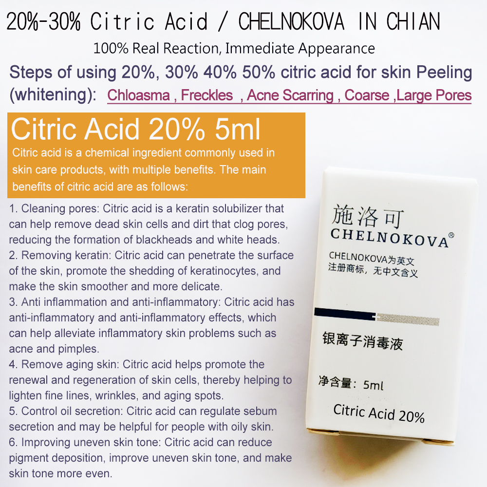 Chelnokova-Peeling Acid TCA20, Peeling Acid, AHA, 10%, 30%, 50%, 70%, 100%, 5ml, Chemical ...