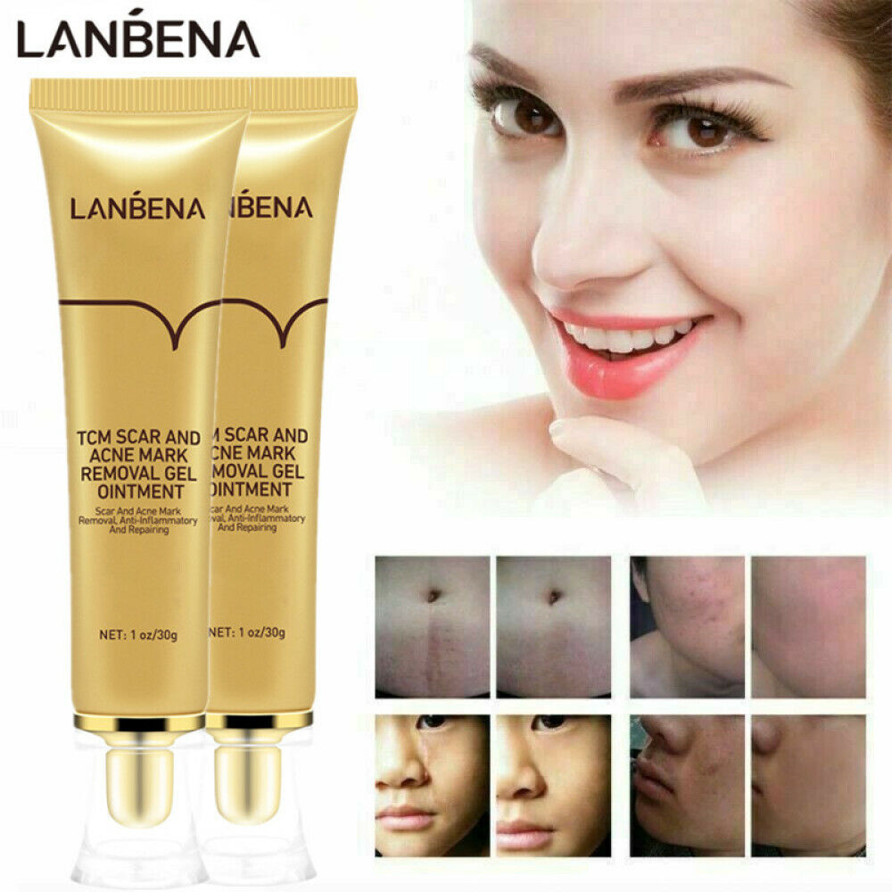 Lanbena TCM Scar Removal Gel / Cream / Ointment for Surgery, Injury, Burns Keloids, Acne Stretch ...