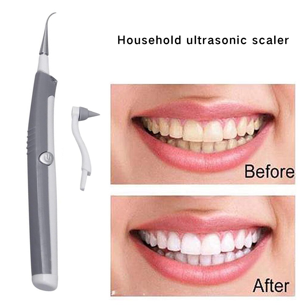 Tartar Sonic Tool Ultrasonic Tooth Cleaner Stains Electric Calculus ...