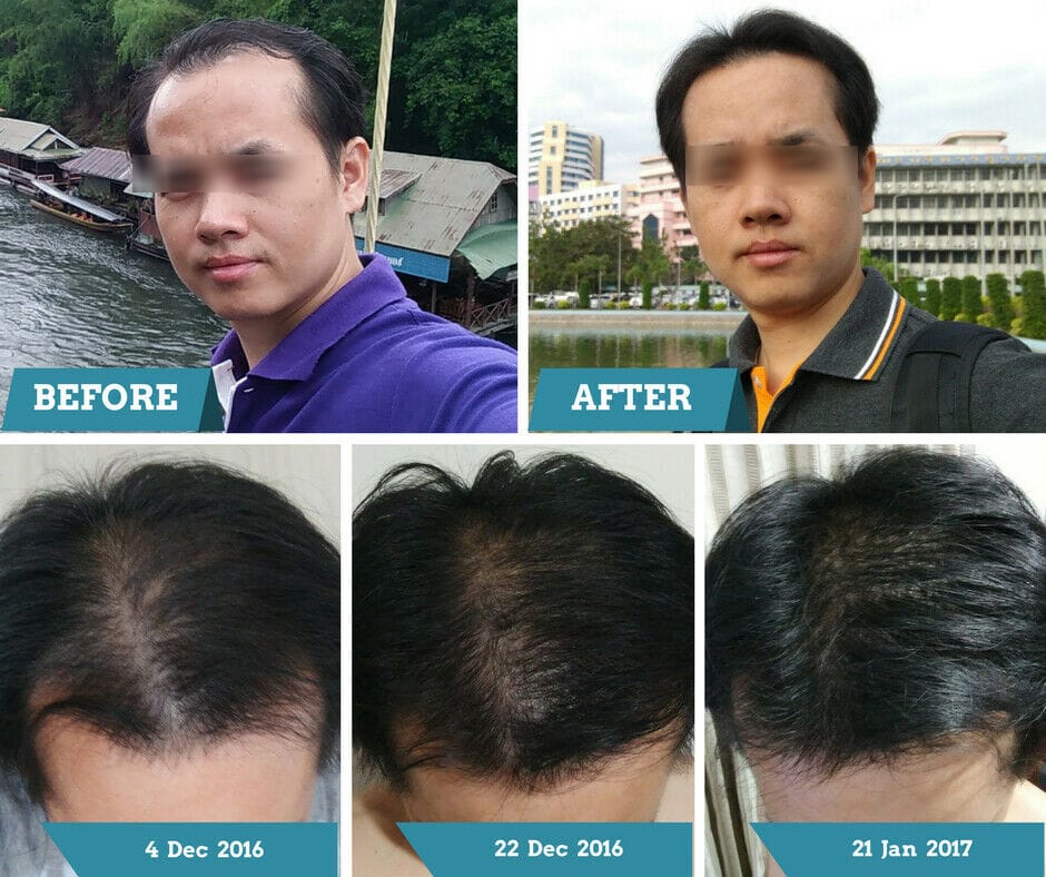 Rabbit Blood Herbal Hair Oil 100ml, Natural Rabbit Blood hair Growth ...