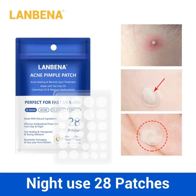 LANBENA Acne Pimple Patch 28pcs/sheet Acne Fast Healing Blemish Spot ...
